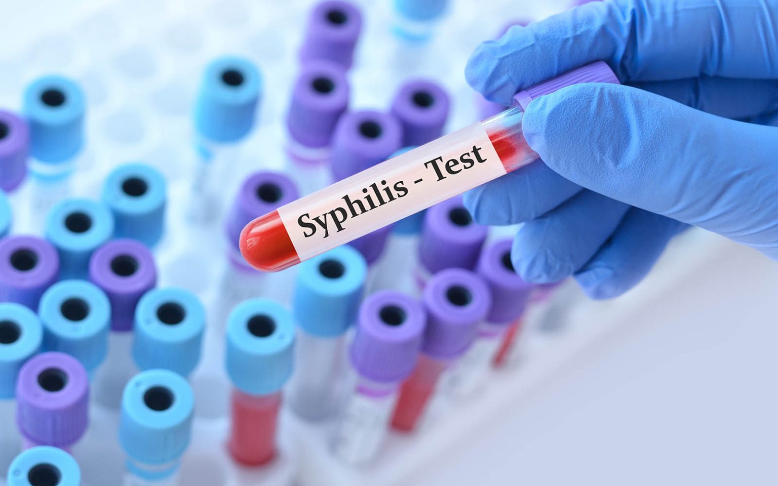 Alarm Over Spike in Syphilis Infections With Women Mostly Hit - Kenya ...