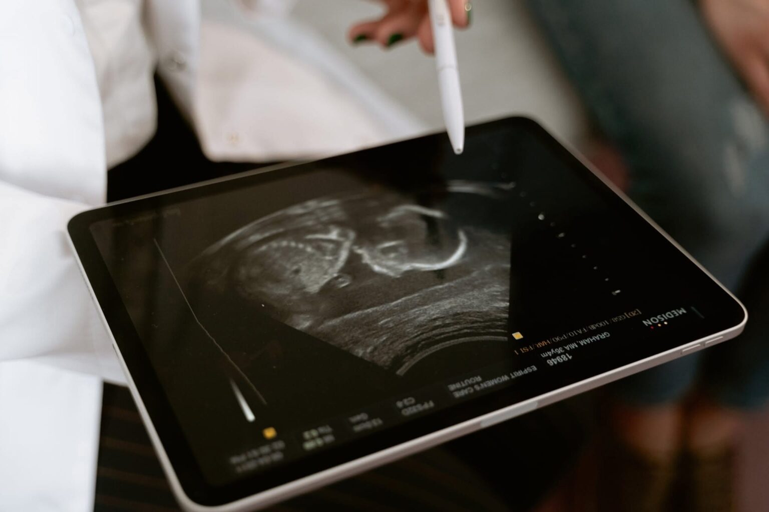 Fertility Point's House of Horrors: Wrong Sperm, Disputed Babies, a ...